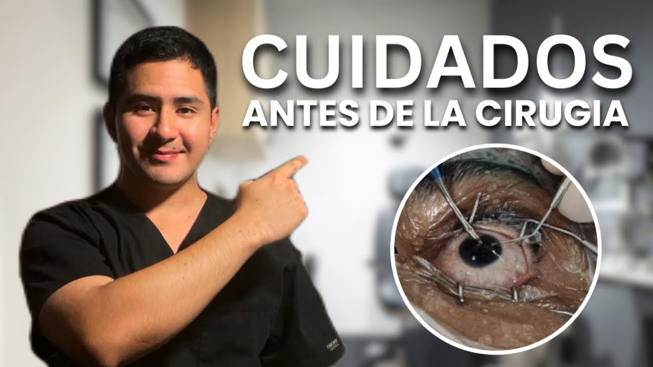 ¿Cómo PREPARASE para una Cirugía Ocular? | los 5 MEJORES Consejos ...