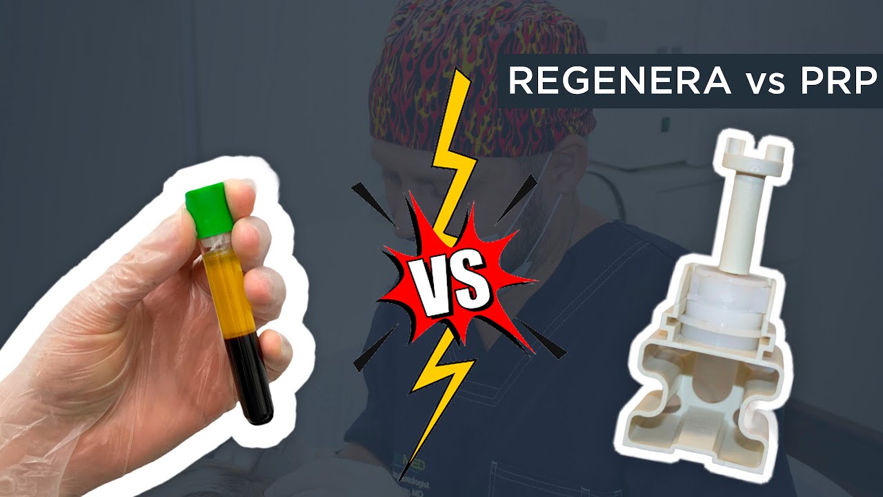 REGENERA vs PRP - YouTube