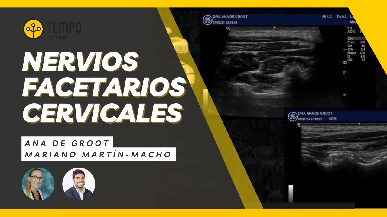 Nervios facetarios cervicales con Ana de Groot y Mariano Martín-Macho # ...