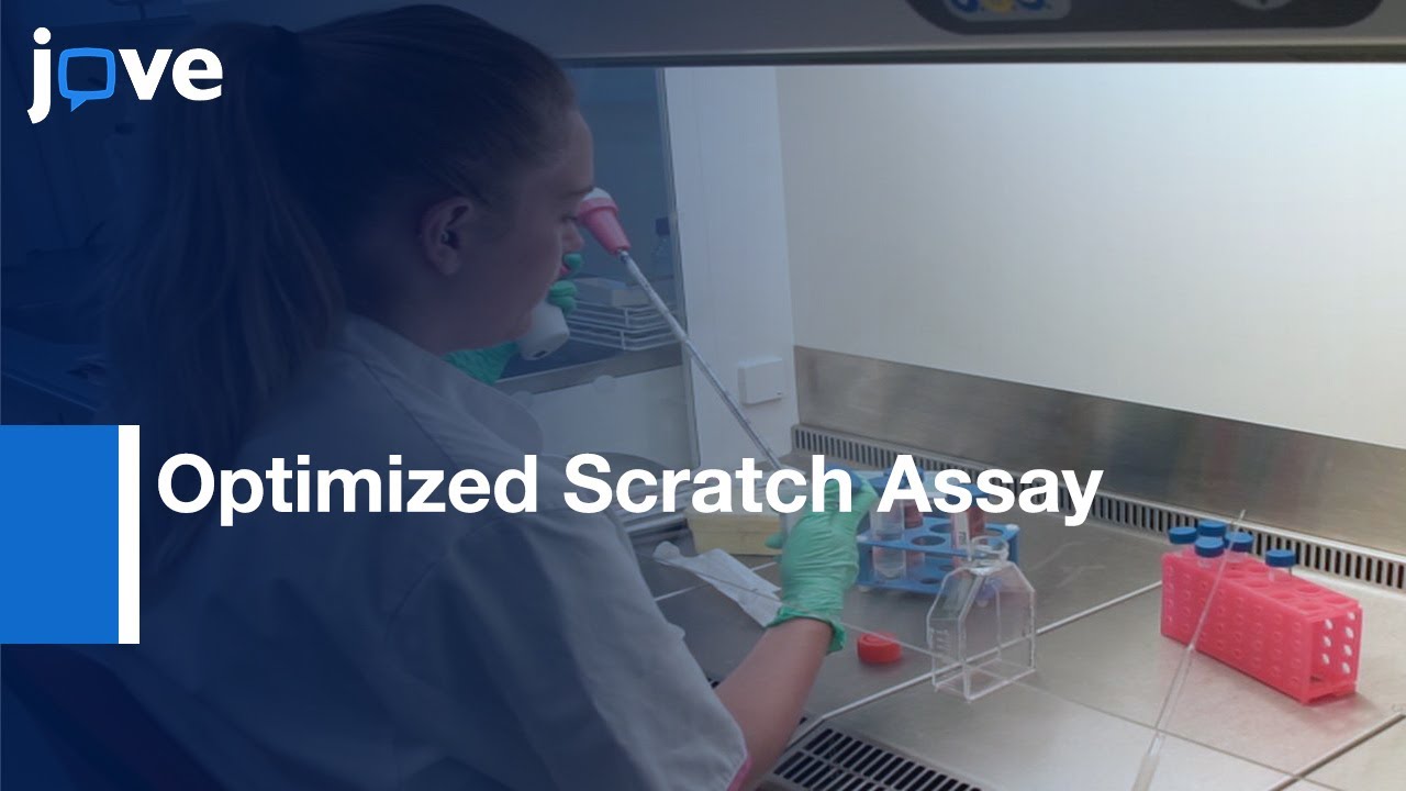 Optimized Scratch Assay: Testing Of Cell Migration With Automated ...