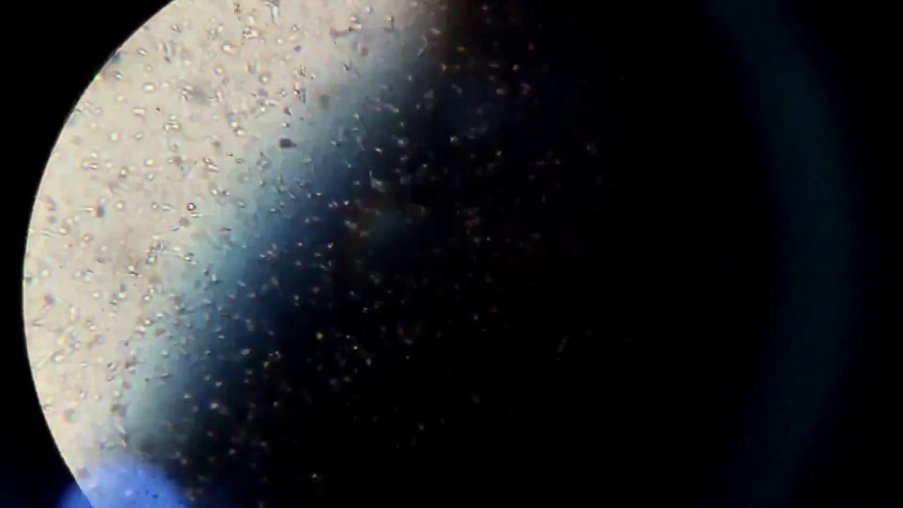 Semen analysis - normal under microscope - YouTube