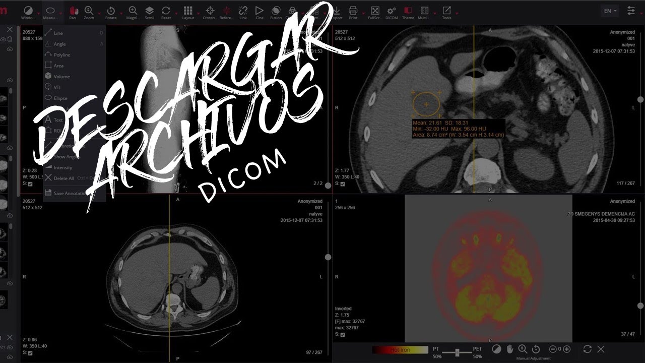 Descargar archivos DICOM del sistema - YouTube