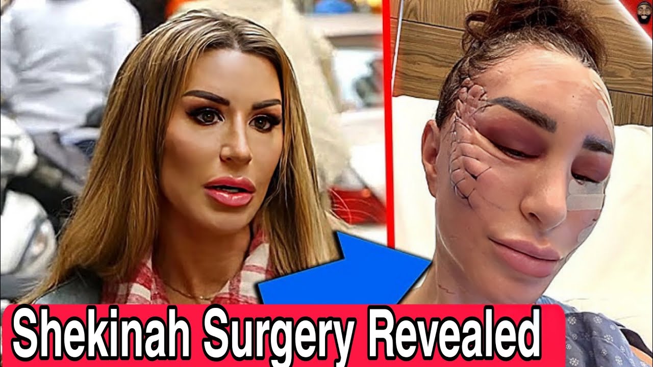 "Unbelievable Transformation! Inside Shekinah's 90-Day Surgery Journey ...