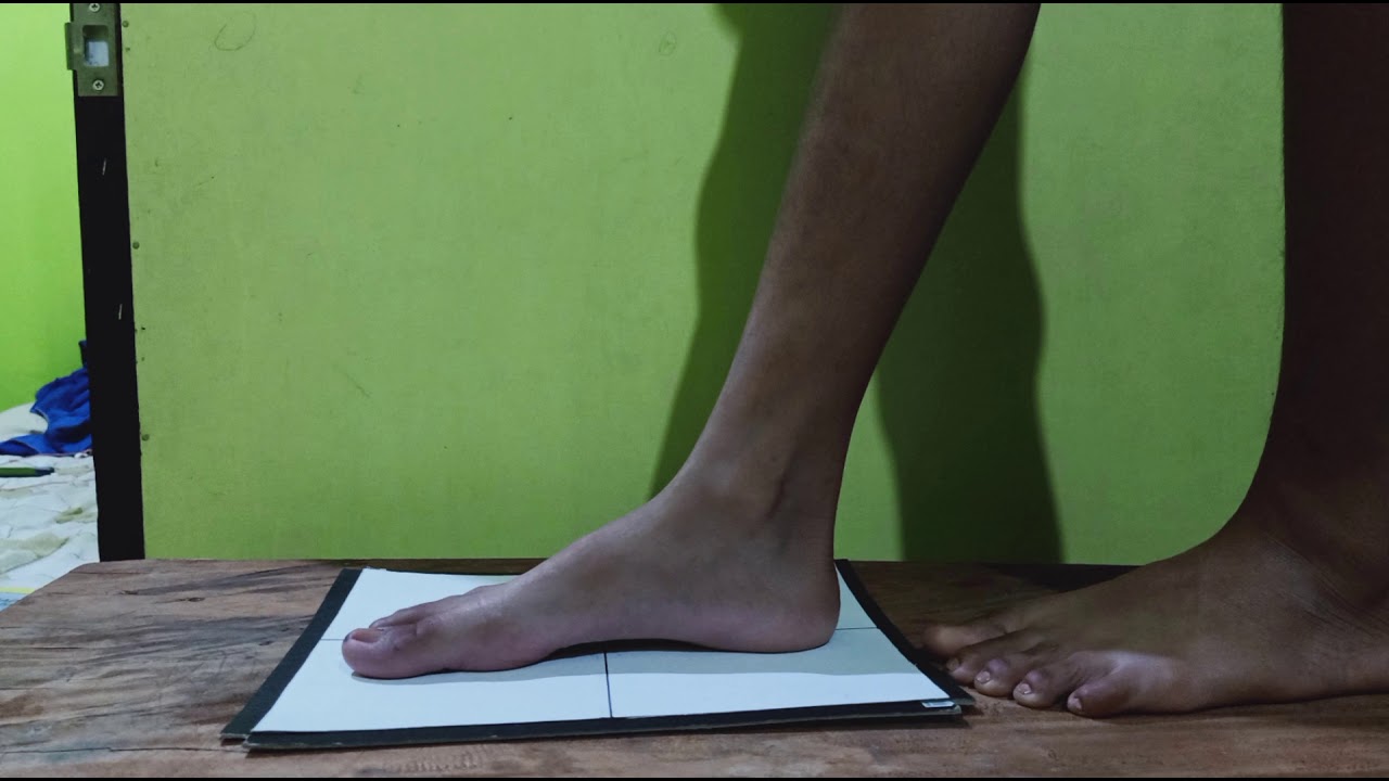 RADIOGRAPHIC POSITIONING! LOWER EXTREMITIES!!! - YouTube