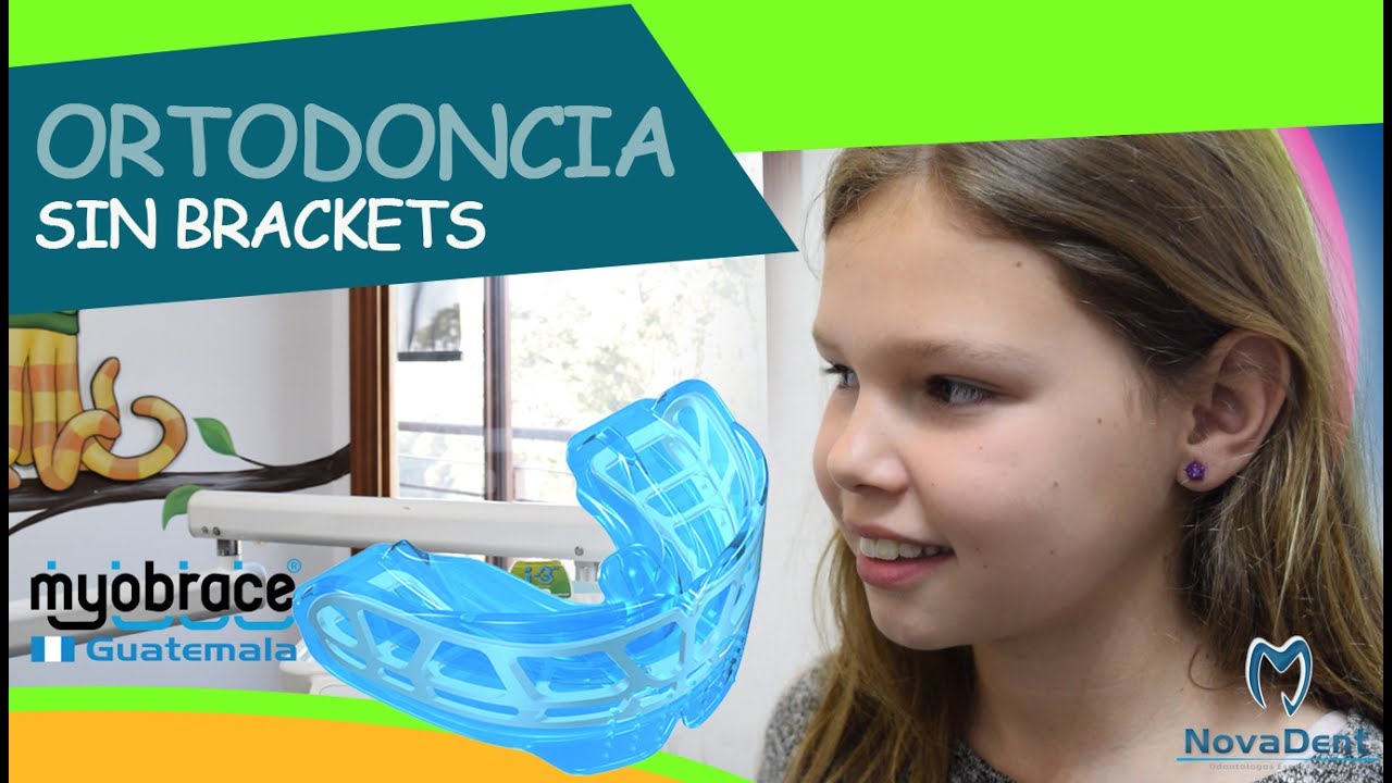 90% menos Brackets - La ortodoncia tradicional quedo atras... Novadent ...