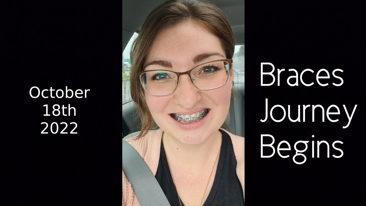 Braces Journey Begins {10-18-22} - YouTube