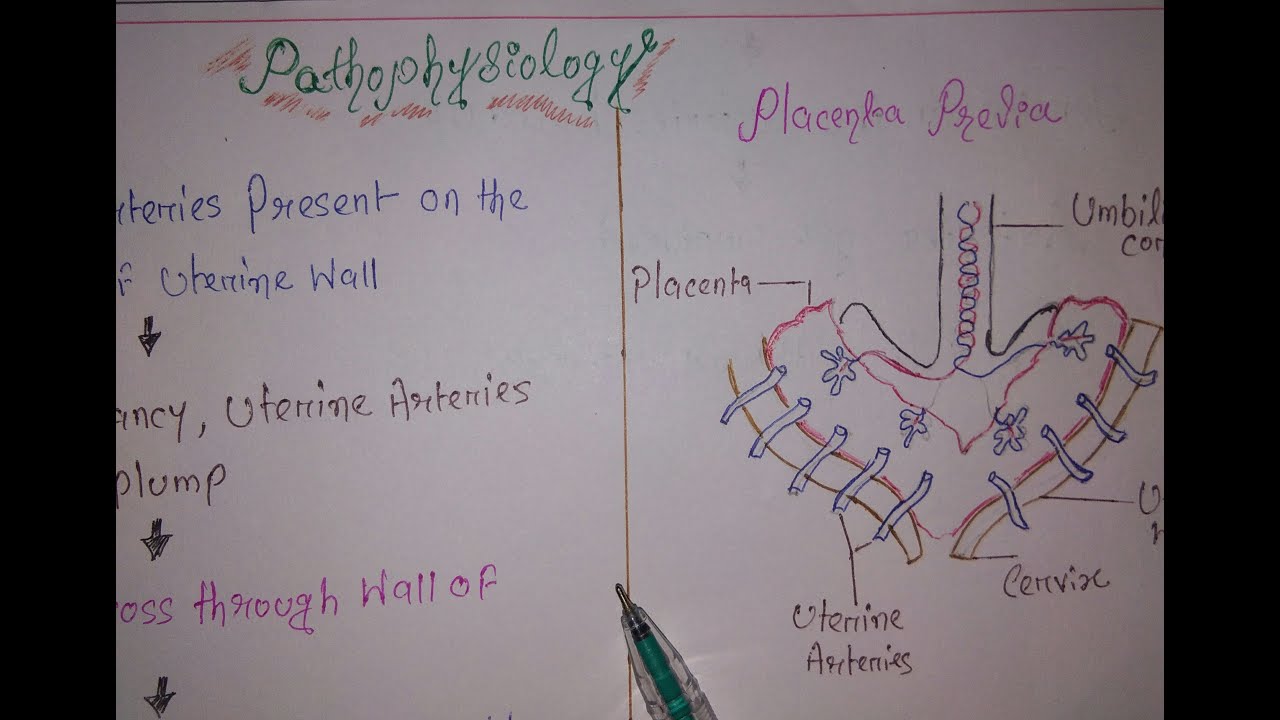 PATHOPHYSIOLOGY OF PLACENTA PREVIA - YouTube