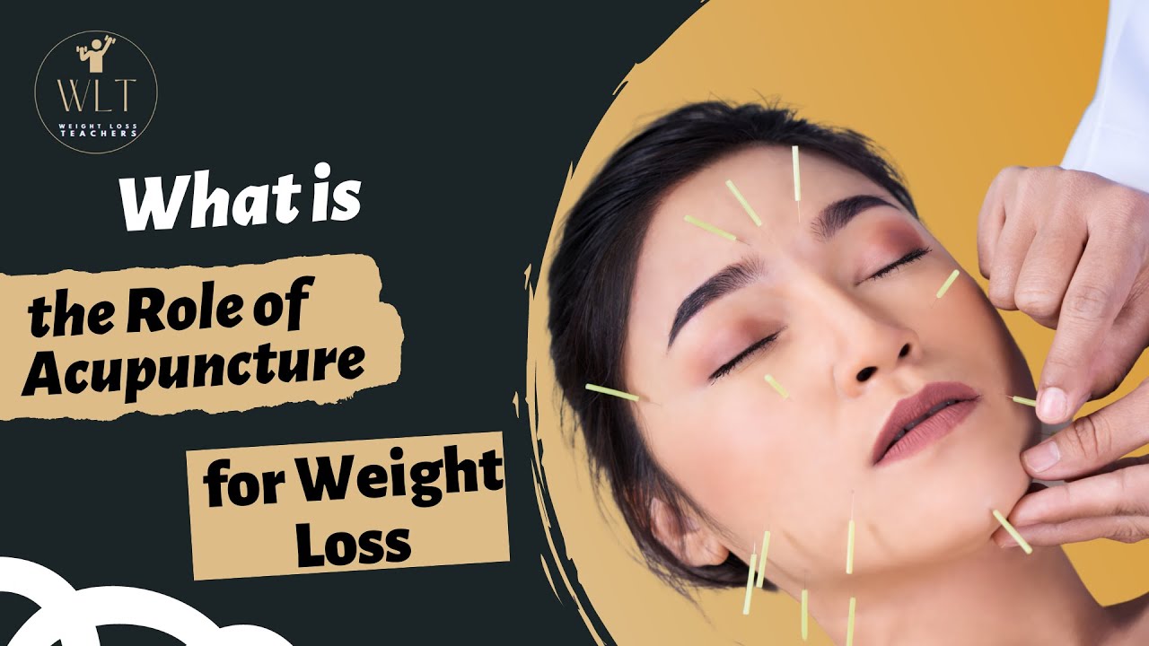 What is the Role of Acupuncture for Weight Loss I Weight Loss Teachers ...