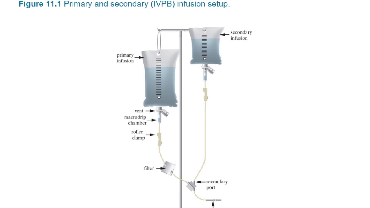 Medical Dosage Calculations - Ch11 - Flow Rates, Dosage Rates for IV ...