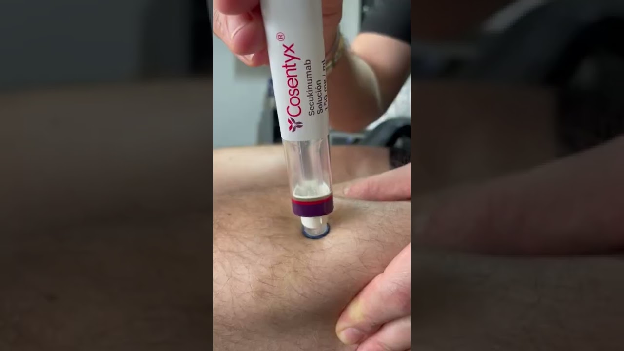 Cosentyx (Secukinumab) - YouTube