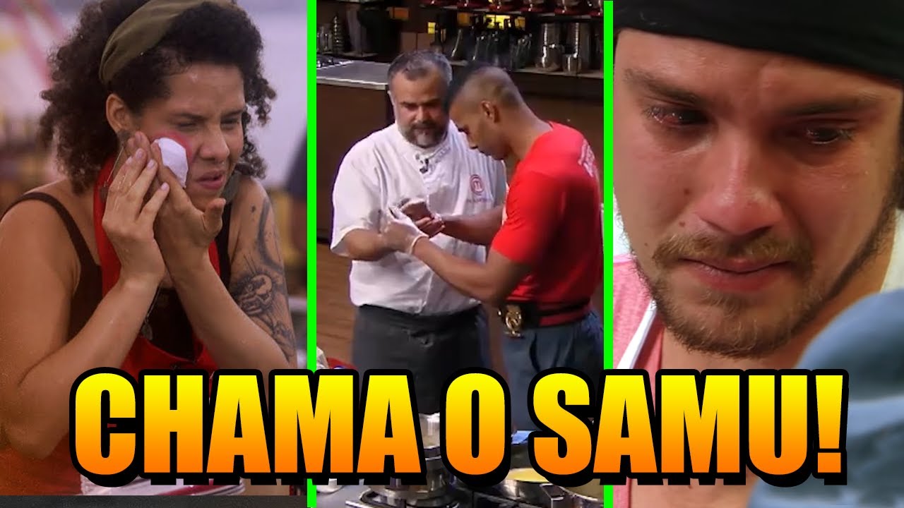 Famosos Que Se Machucaram Feio No Masterchef Youtube