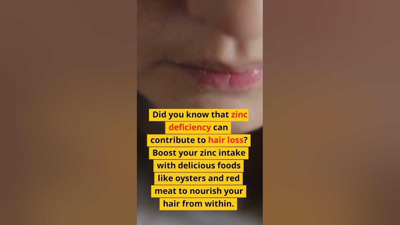 Shorts Hair Loss Prevention And Regrowth 12 Powerful Home Remedies