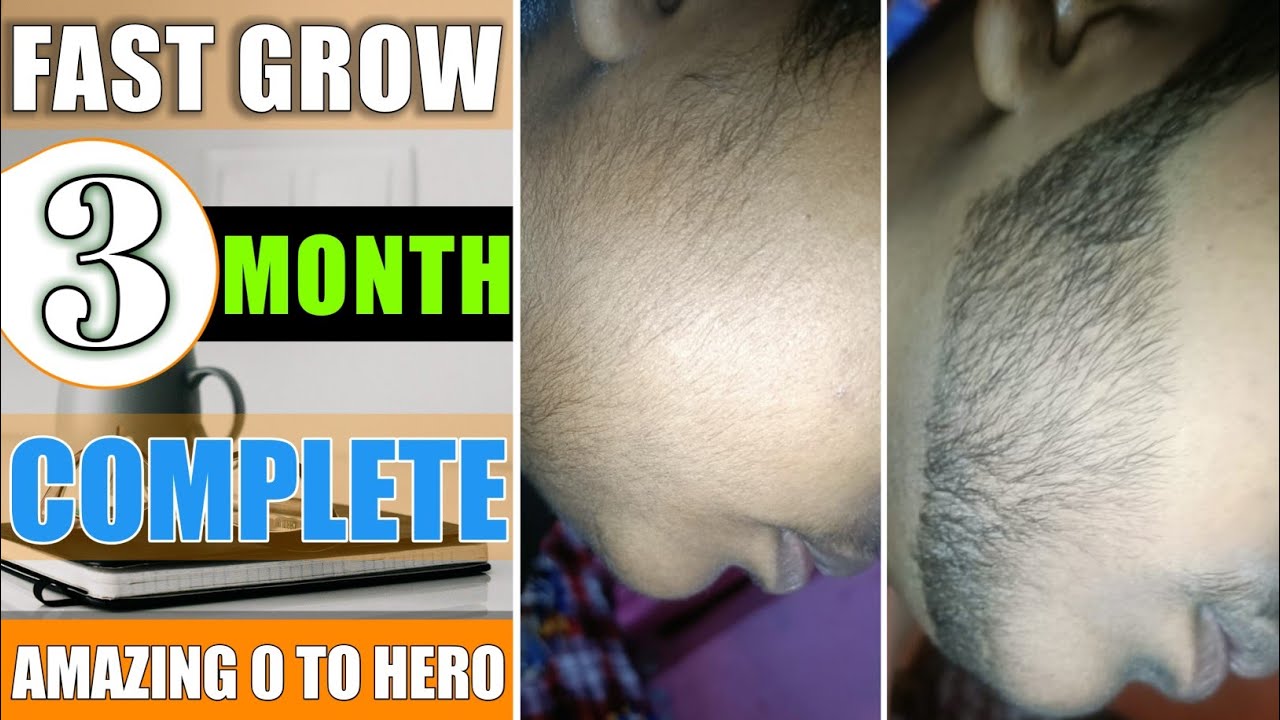 FAST BEARD GROWTH || 3 MONTH COMPLETE || Amazing beard growth result ...