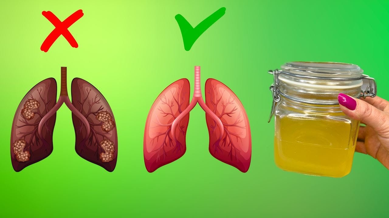 REMÈDE NATUREL contre la toux sèche et la bronchite J'ai sauvé mes ...