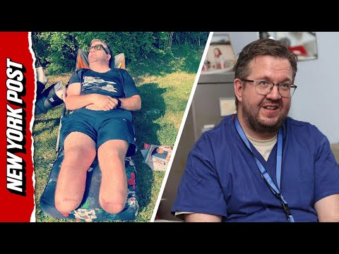 Surgeon Pleads GUILTY After Purposely Amputating Legs for Sexual Fetish