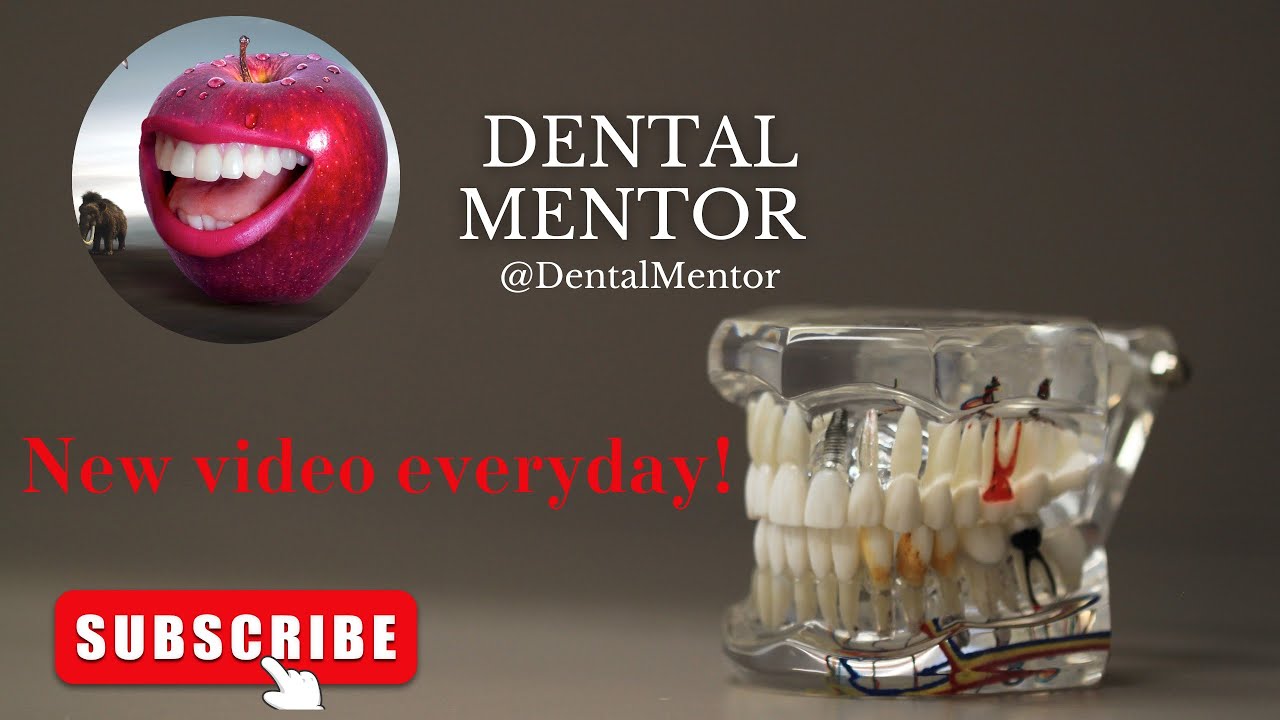 The Dual Zone Approach in Immediate Implant Placement | Part 1/2 - YouTube