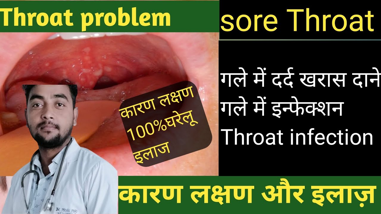 gale main infection! treatment of throat infection #throatchakrahealing ...