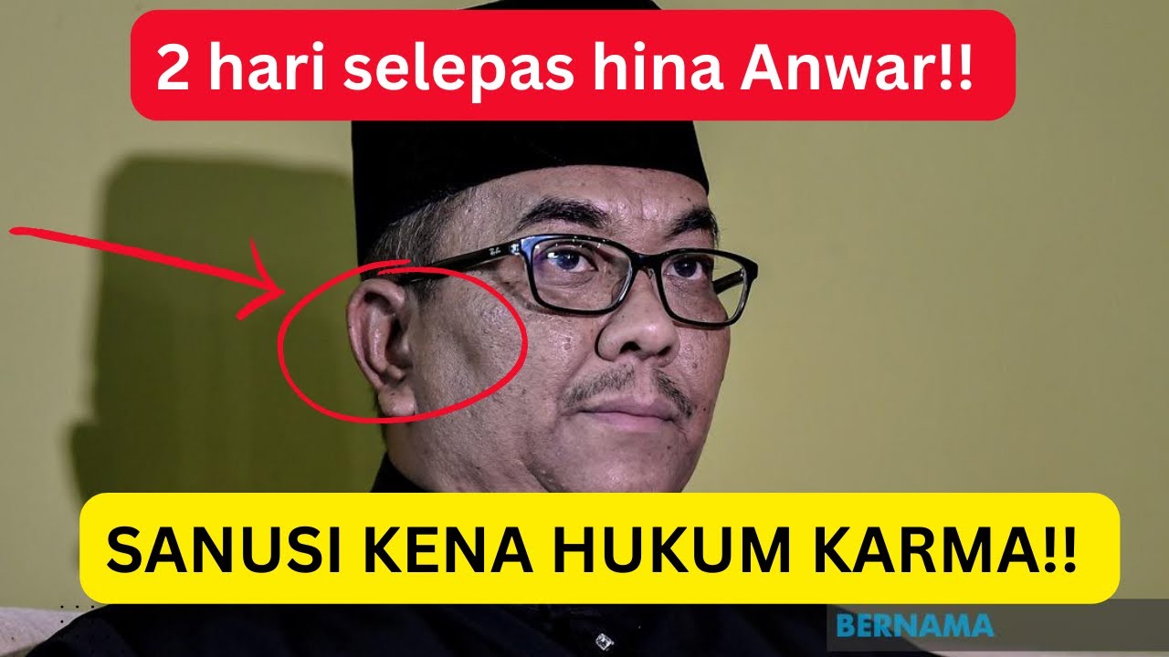 2 hari selepas HINA ANWAR!! Sanusi kena hukum Karma! - YouTube