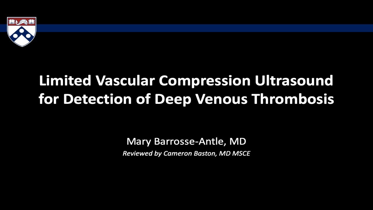 Limited Vascular Compression Ultrasound for Detection of DVT - BAVLS ...