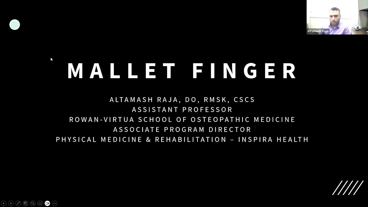 Mallet Finger with Dr. Altamash Raja | AMSSM Sports Ultrasound Case ...