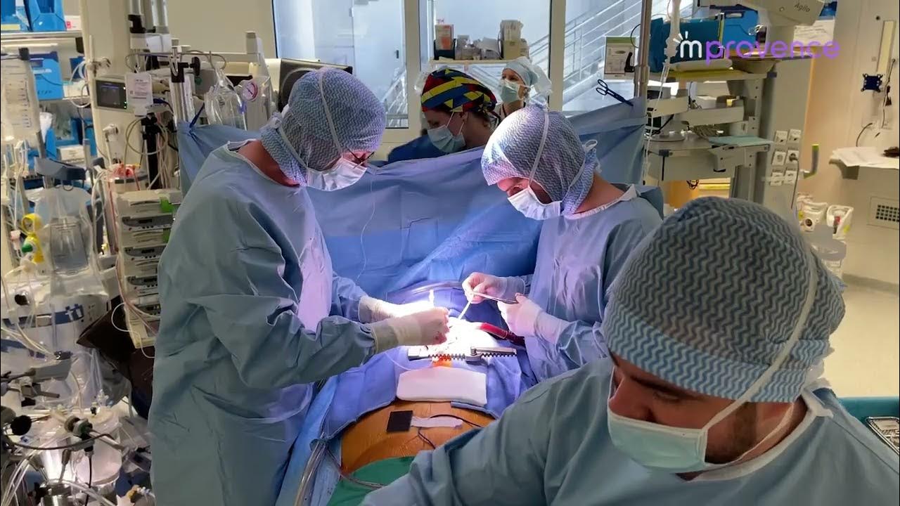 Chirurgie à coeur ouvert : un exploit spectaculaire ! - YouTube