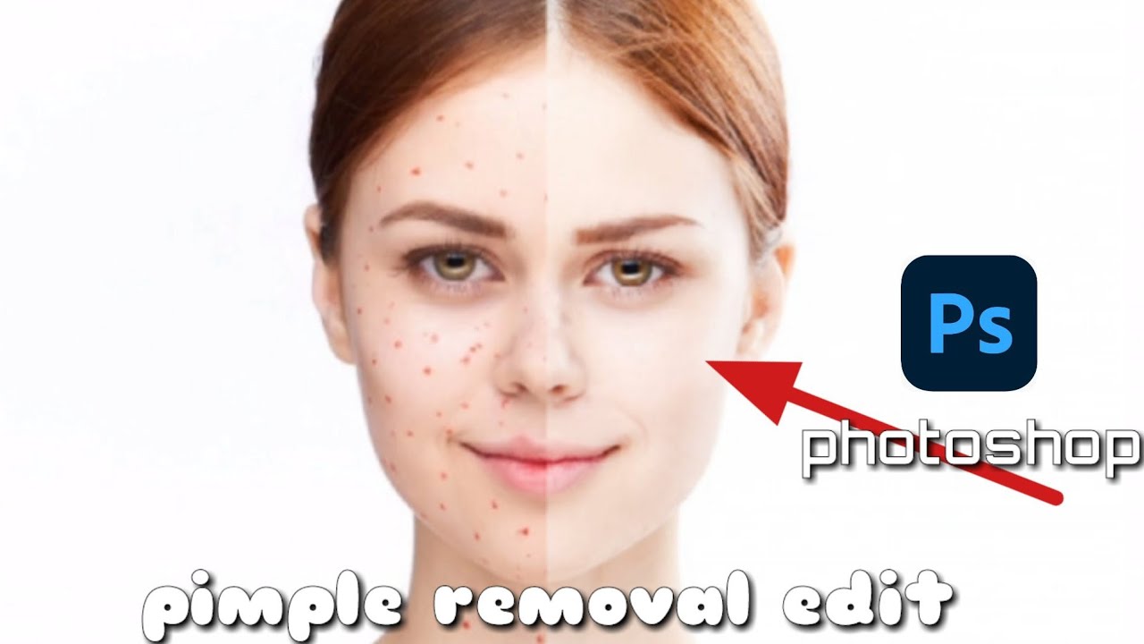 pimple removing and smooth editing in Photoshop||by Avinash tech to all ...