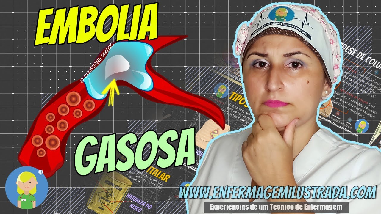 A Embolia gasosa: Como ocorre? - YouTube