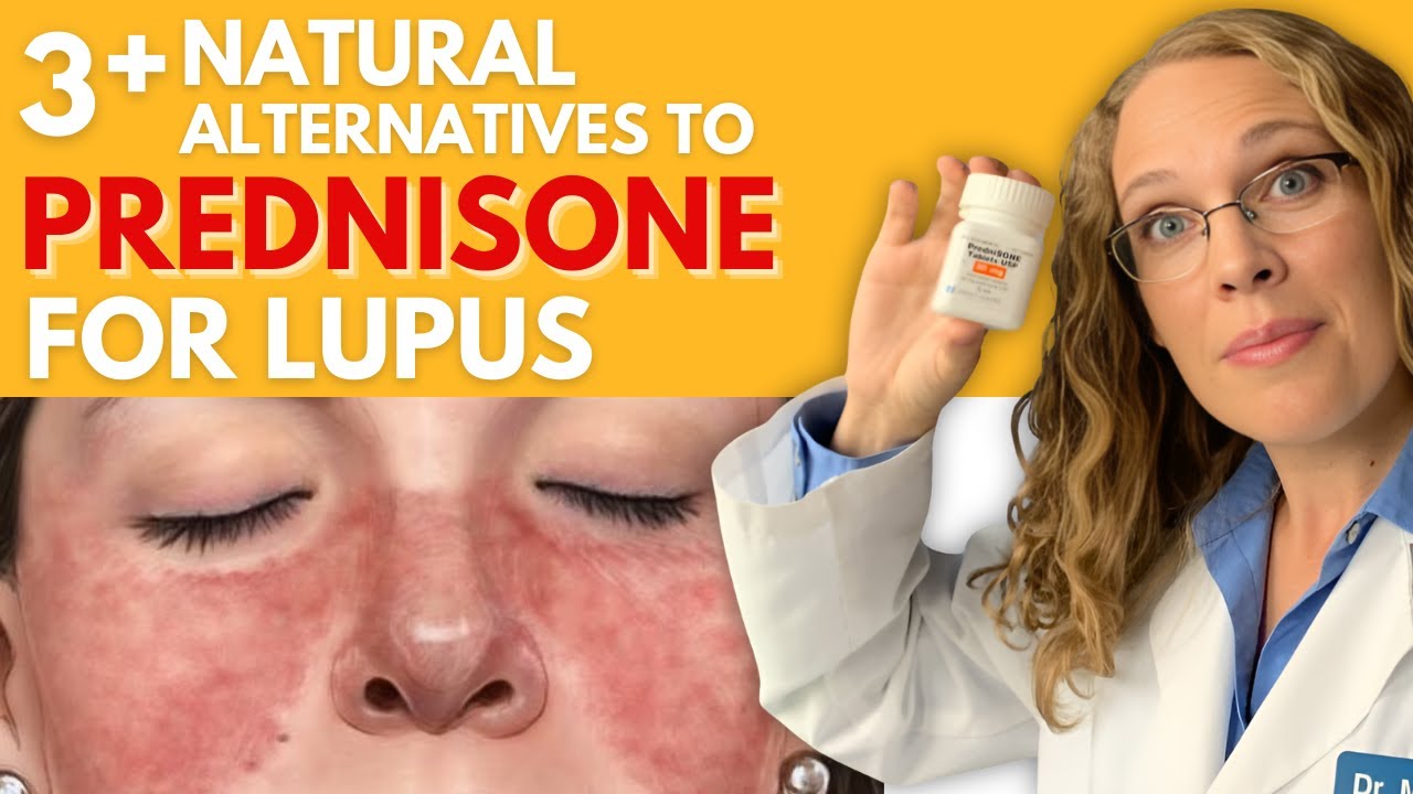 3+ Natural Alternatives to Prednisone for Lupus - YouTube