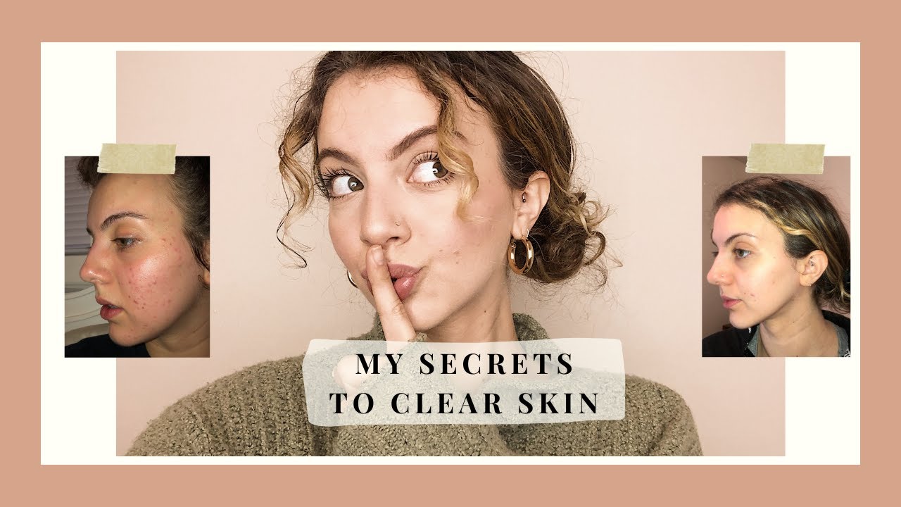 my secrets + tips for acne prone skin | how to get clear skin!! - YouTube