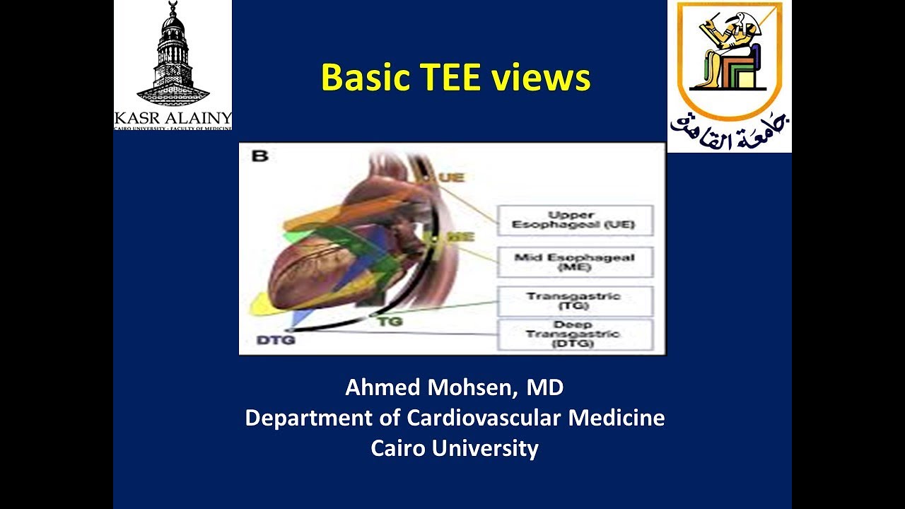 Basic Transoesophageal Echocardiography (TEE) views - YouTube