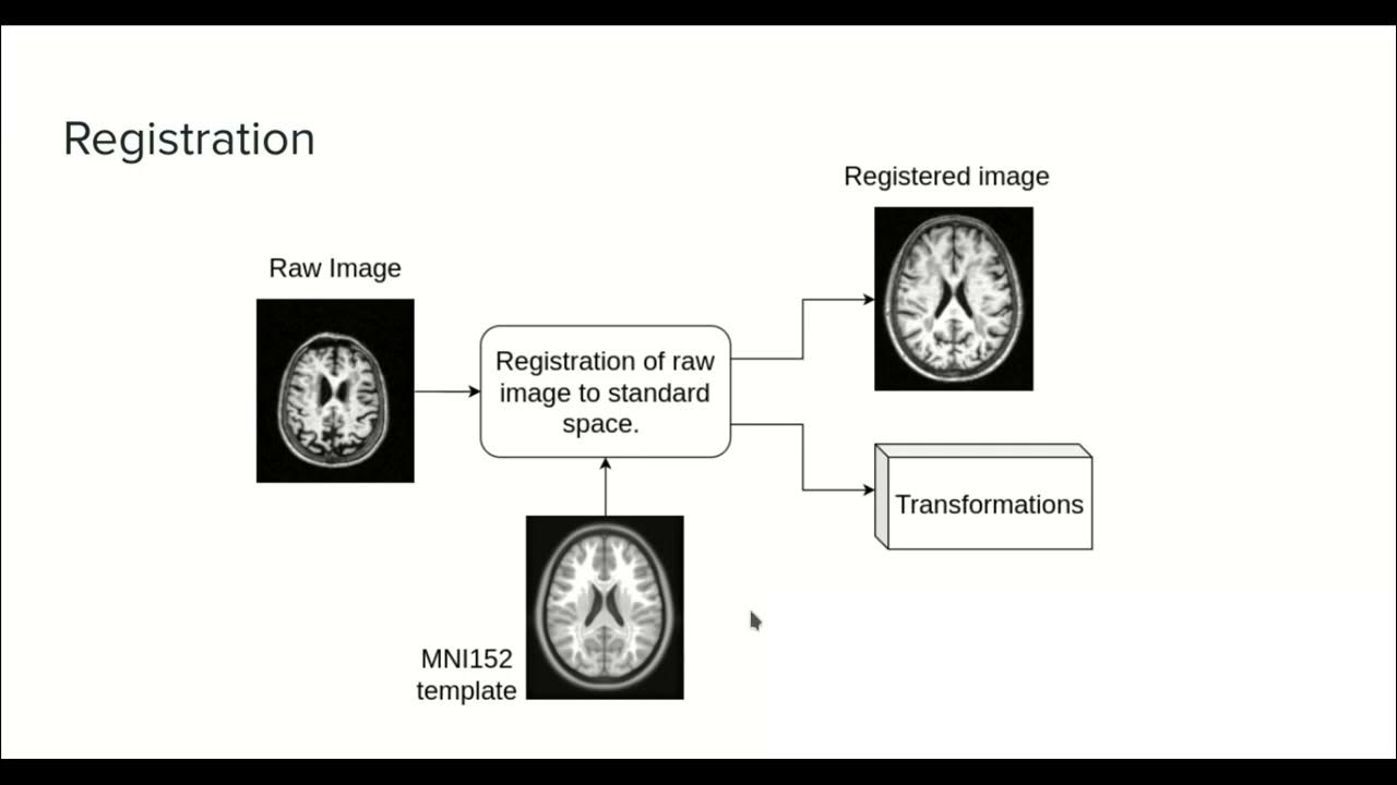 6.0 - MRI image registration with ANTsPy - Course MRI preprocessing with Python - YouTube
