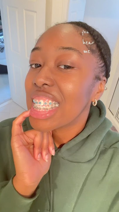TAKING MY BRACES OFF 👀 #braces - YouTube