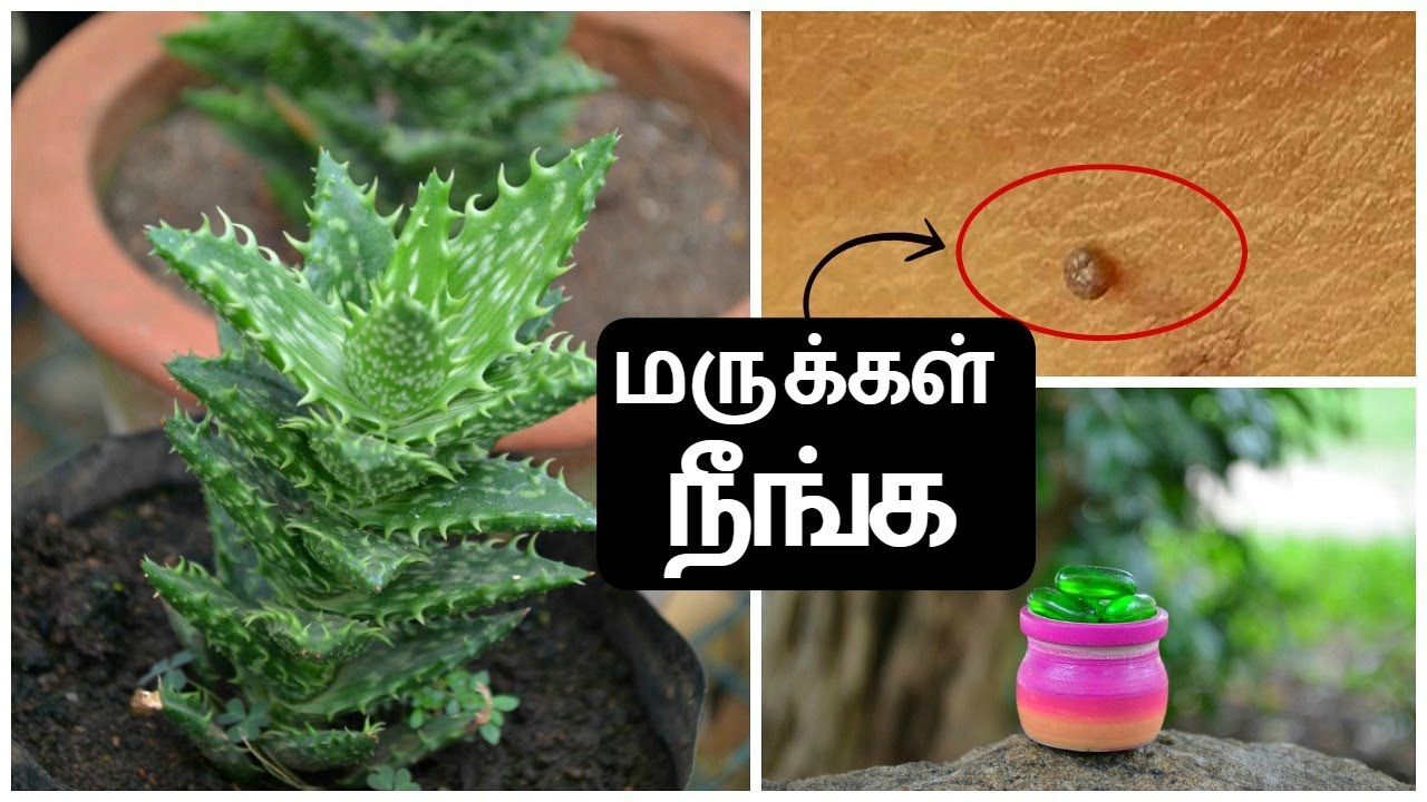 மருக்கள் அடியோடு நீங்க 5 வீட்டு வைத்தியங்கள் | Marugu Treatment In ...
