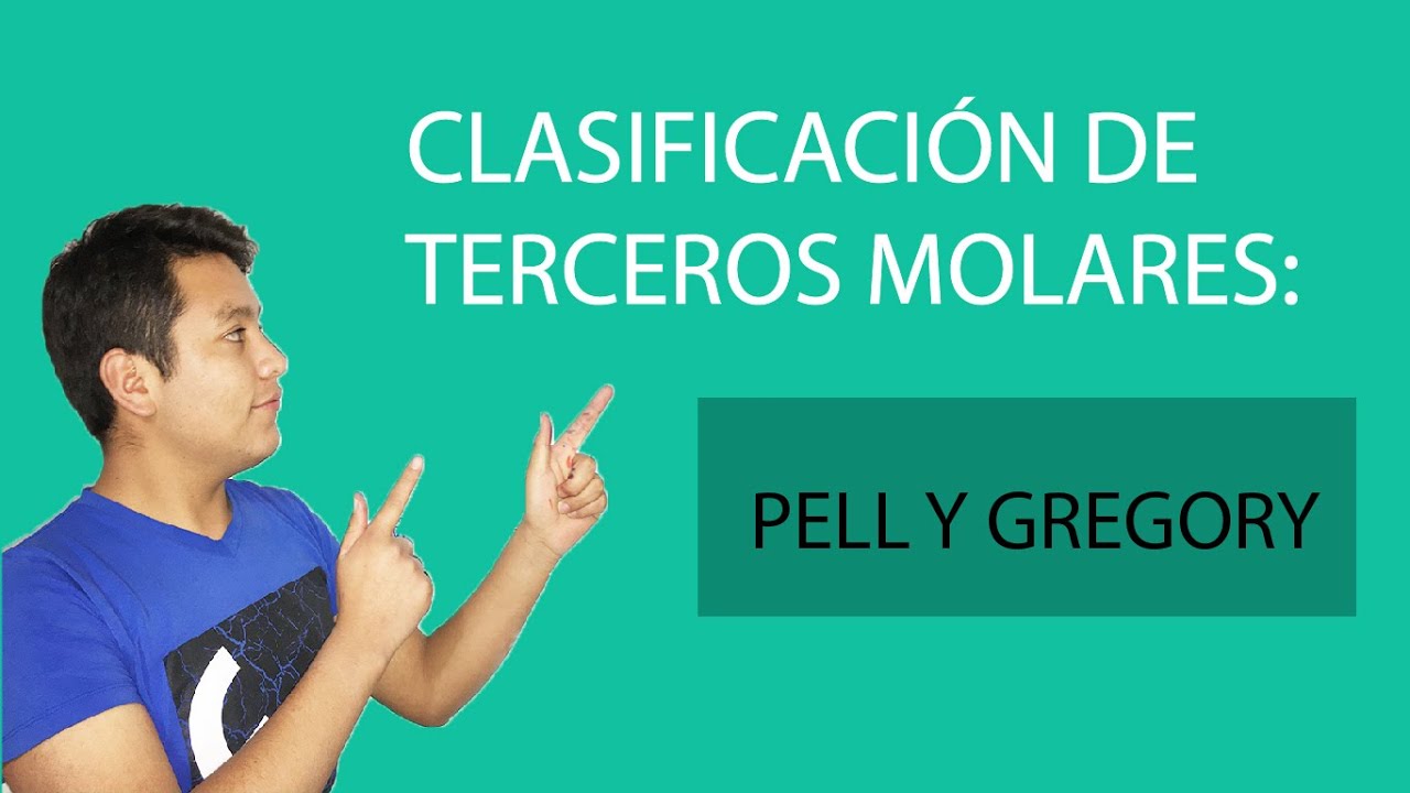 Clasificación de Terceros Molares según PELL Y GREGORY : En Cirugía ...