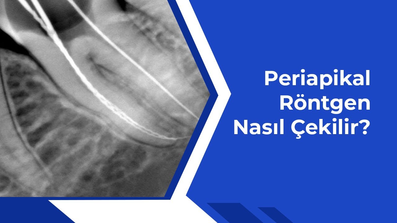 Periapikal Röntgen Nasıl Çekilir? - YouTube