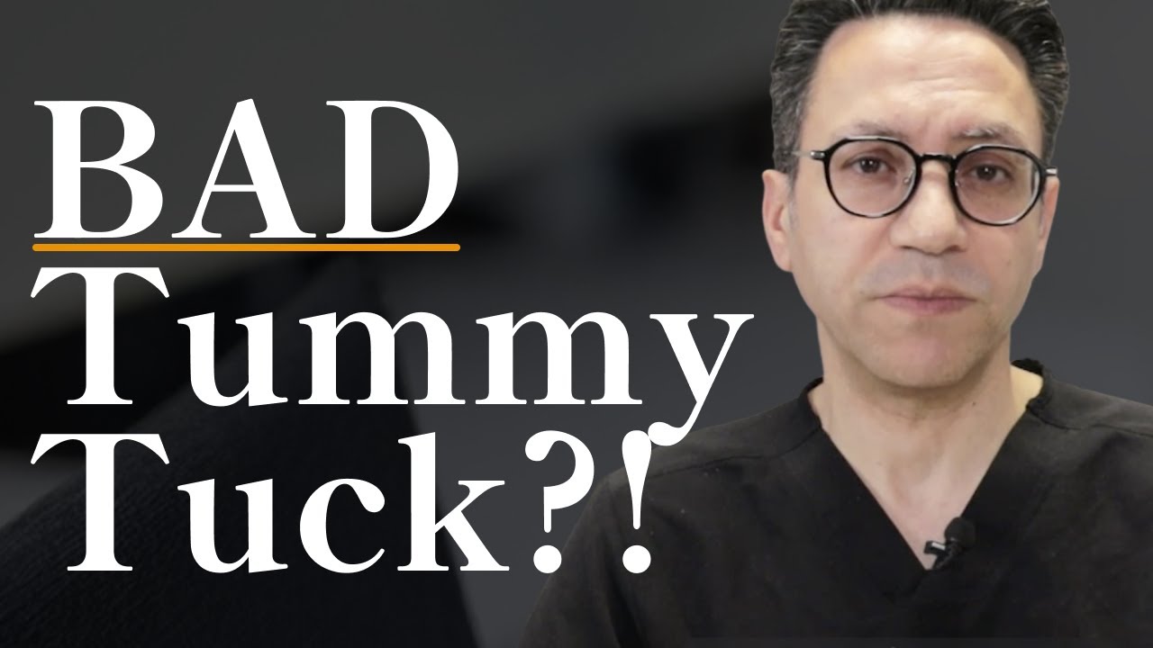 Signs of a Bad Tummy Tuck: How to Spot & Fix Botched Results | UK ...