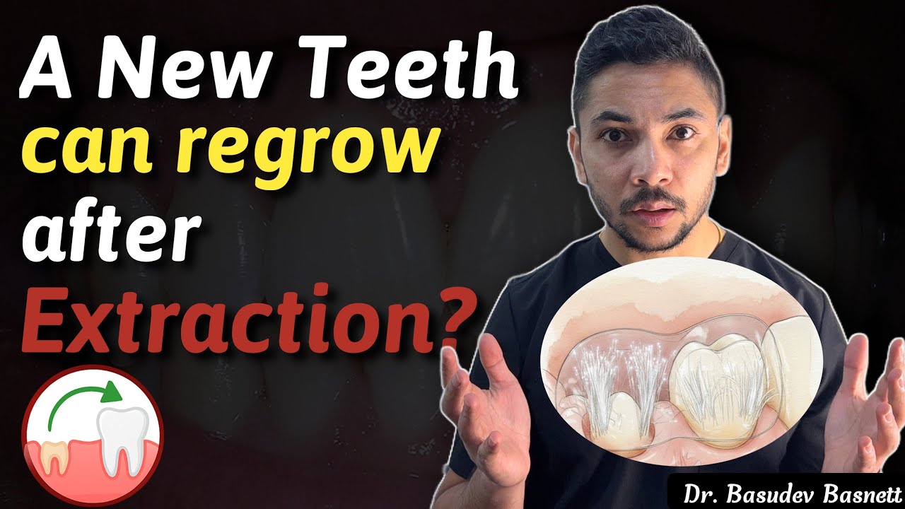 A New Teeth can grow after extraction in adults | Dentist Explains😳 ...