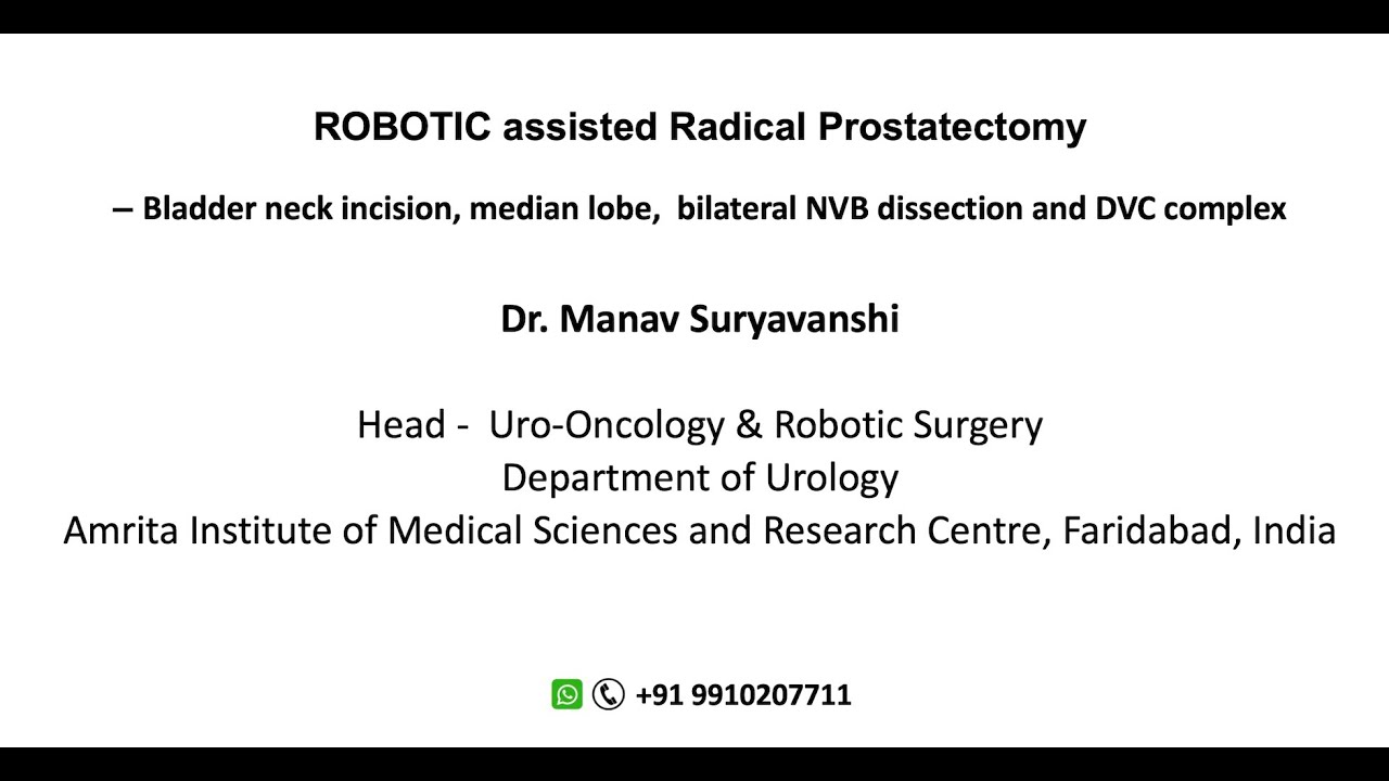 RARP - Bladder neck incision, median lobe, bilateral NVB dissection and ...