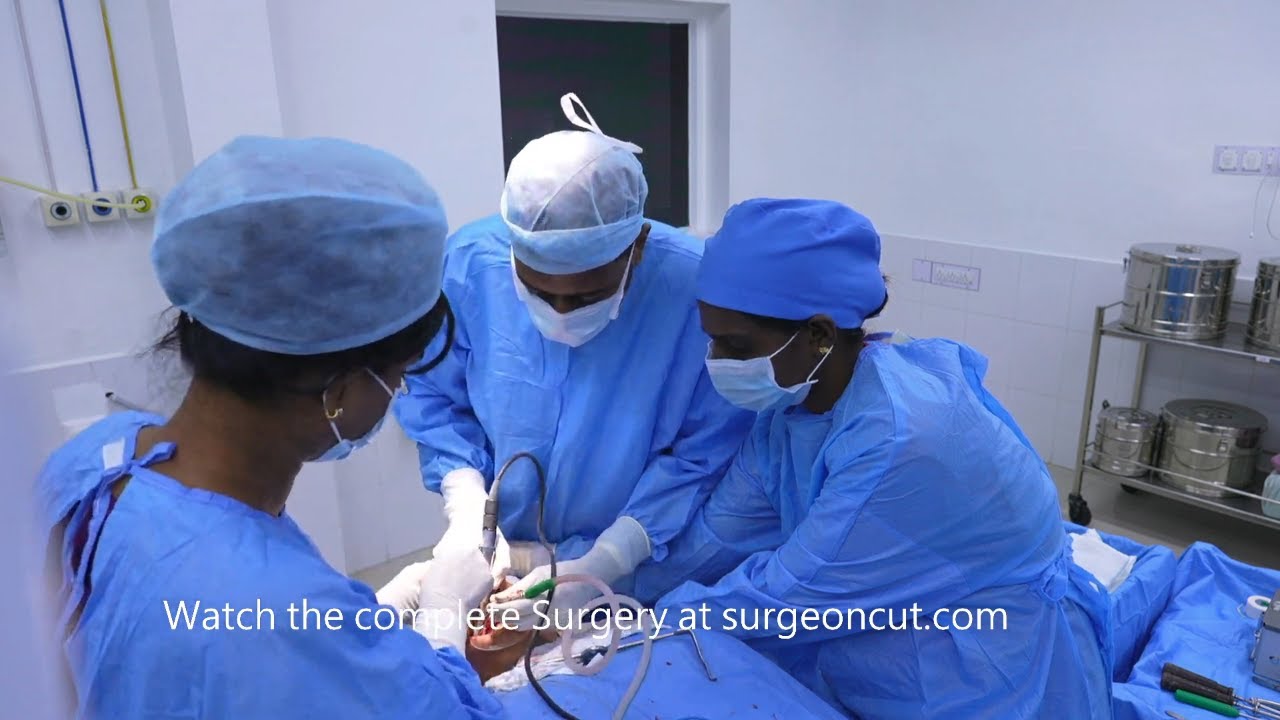 Genioplasty Surgery 3rd for the Day Live - Surgeoncut.com - YouTube