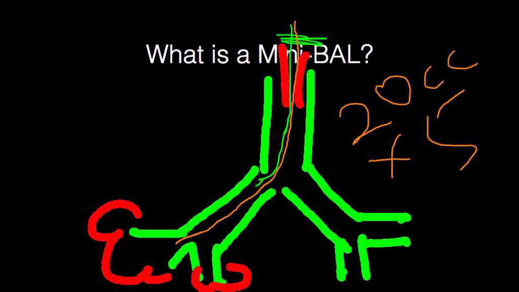 What is a Mini BAL (Bronchoalveolar Lavage) - YouTube