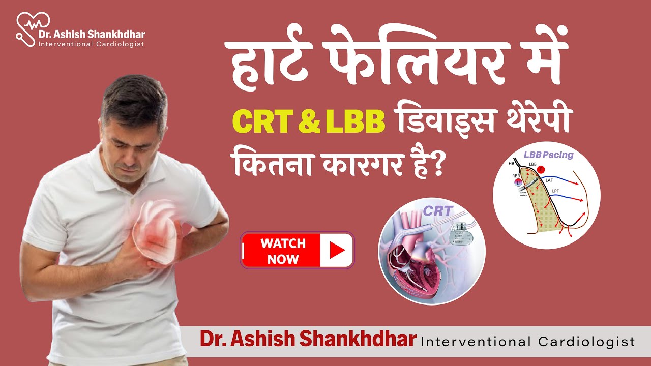 CRT & LBB Device Therapy In Heart Failure | Heart Failure Treatment In ...