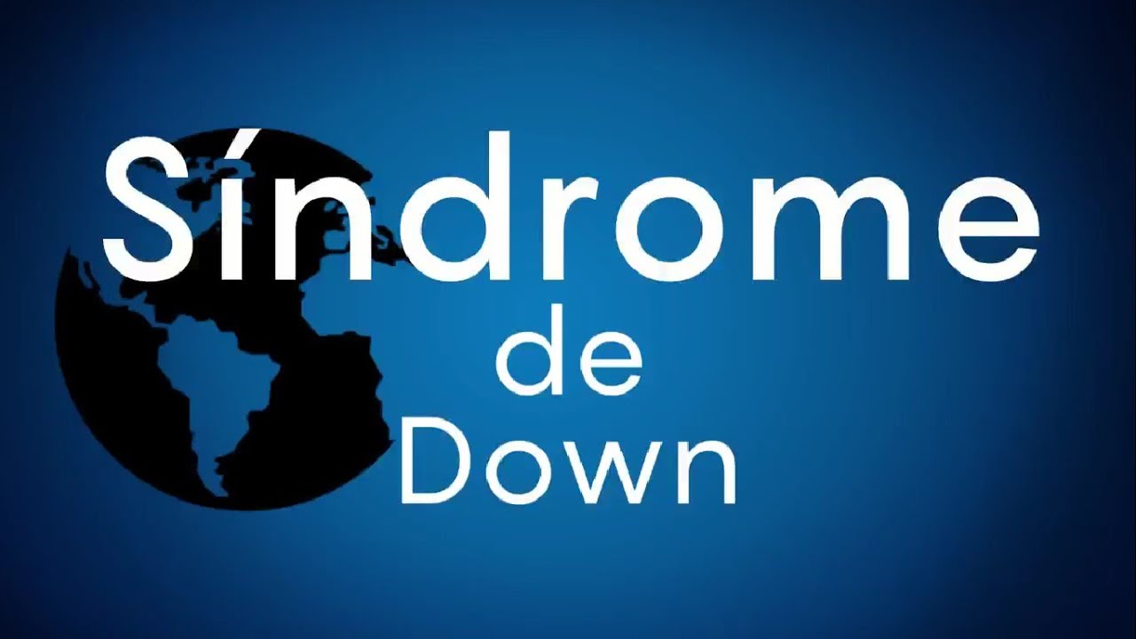 ¿Qué es el Síndrome de Down? - #ExclusivoMSP - YouTube