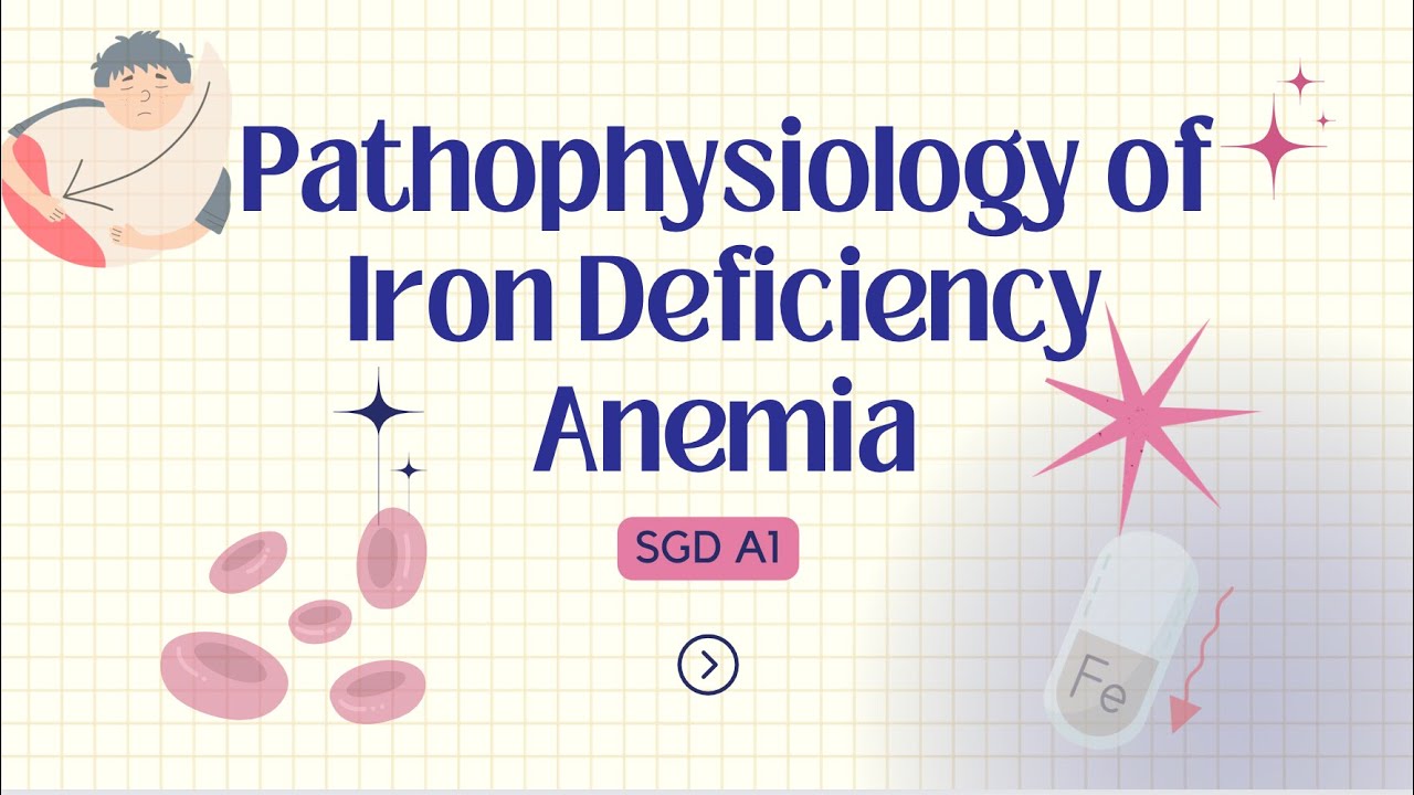 Student Project A-1 Pathophysiology of Iron Deficiency Anemia - YouTube