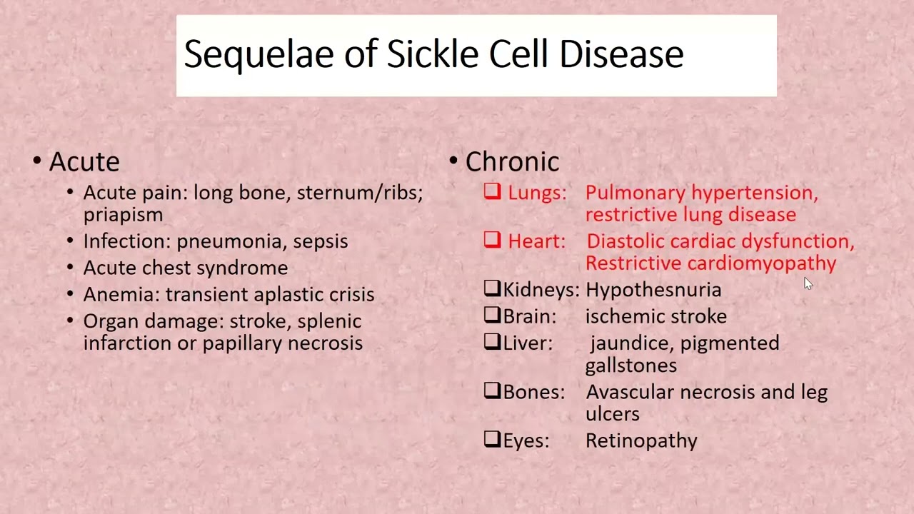 Cardiovascular Effects of Sickle Cell Disease - YouTube