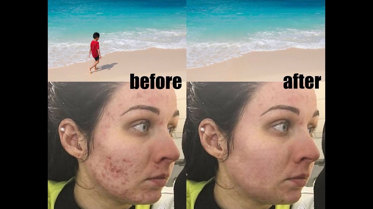 Complete guide to all Healing tools in Photoshop - YouTube