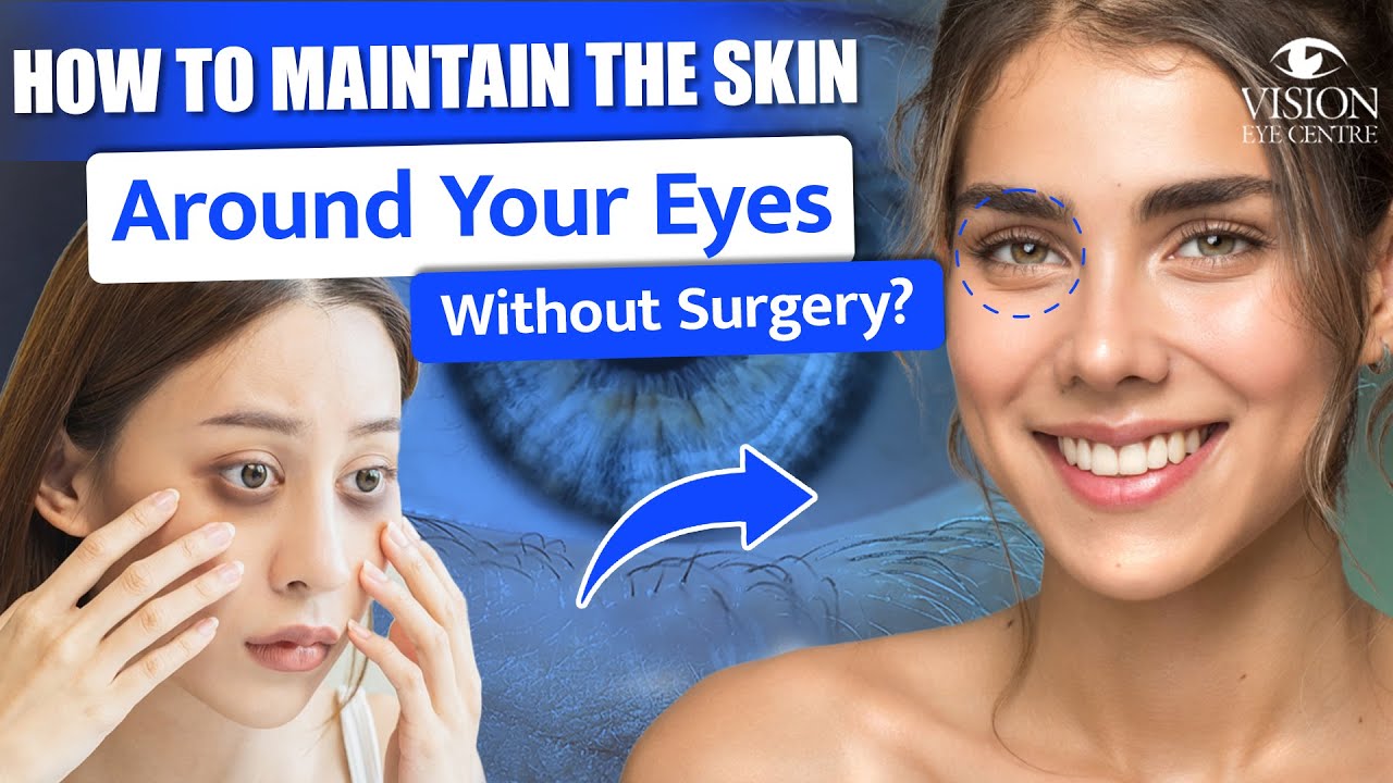How to Maintain the Skin Around Your Eyes Without Surgery? | Ultimate ...
