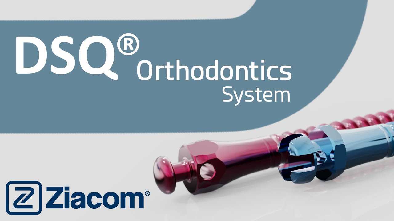 DSQ | Microimplantes para tratamientos de ortodoncia - YouTube