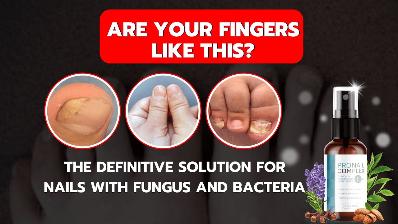 👉 Pronail complex - THE DEFINITIVE SOLUTION FOR NAILS WITH FUNGUS AND ...