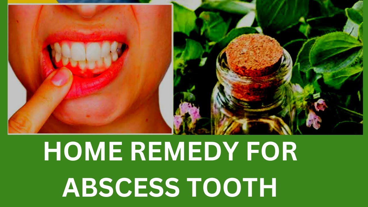 Home Remedy For Abscess Tooth Home Treatment For Gum Abscess Youtube