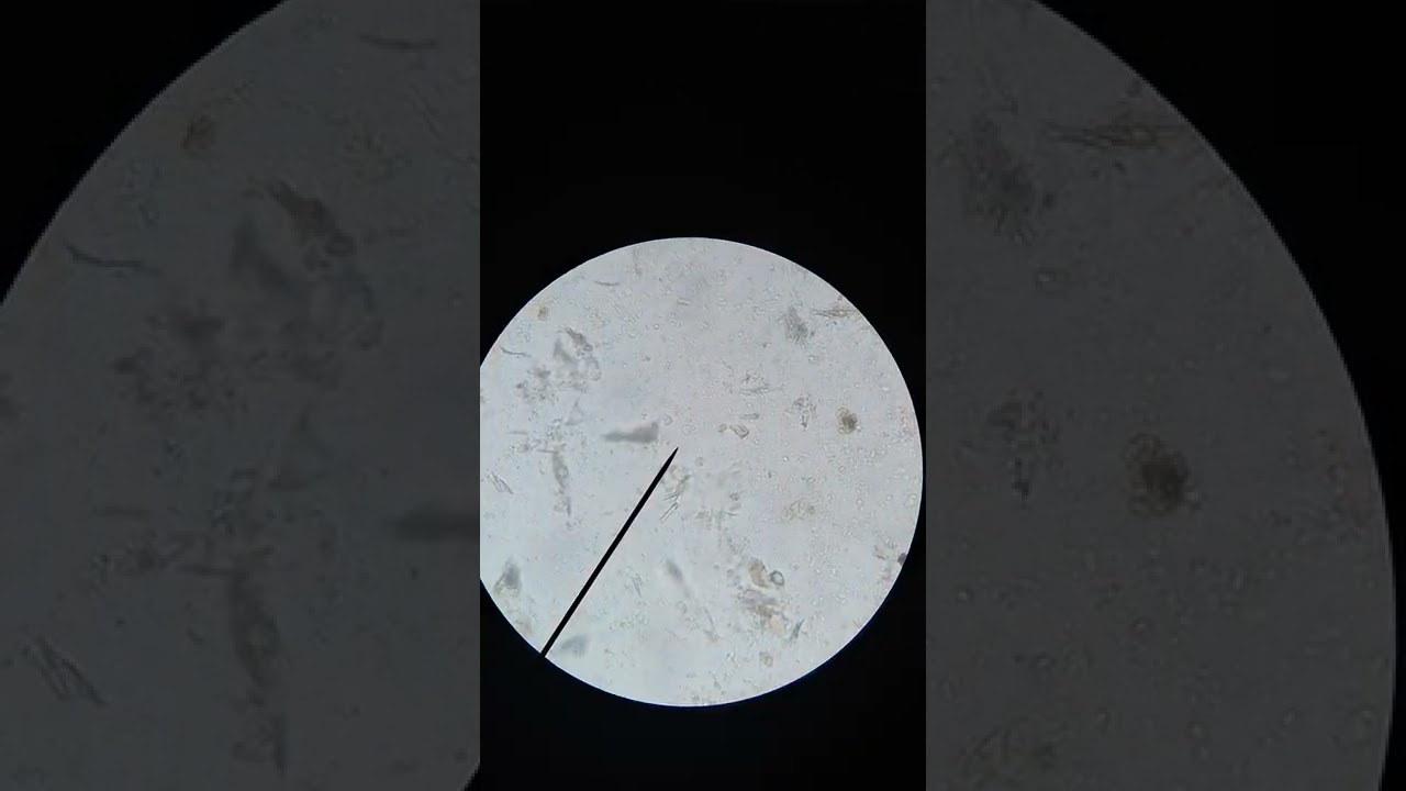 Al Microscopio - YouTube
